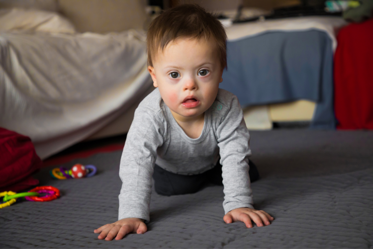 Everything Parents Need to Know About a Trisomy 21 (Down Syndrome) Dia ...